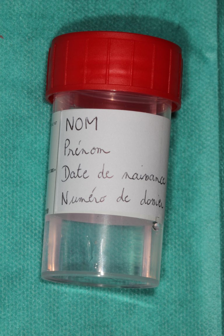Comment faire un prélèvement de qualité ? – Dermatologie buccale