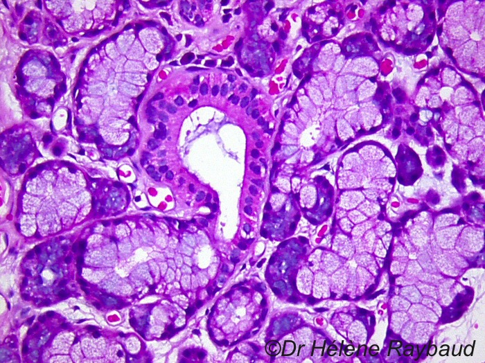 Glandes salivaires – Dermatologie buccale