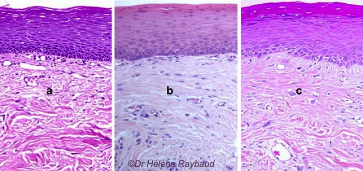 Histologie de la muqueuse buccale – Dermatologie buccale
