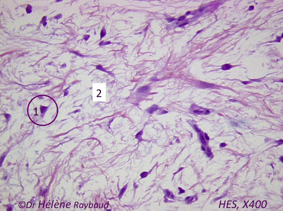 Cas 3 – Garçon de 14 ans – Dermatologie buccale