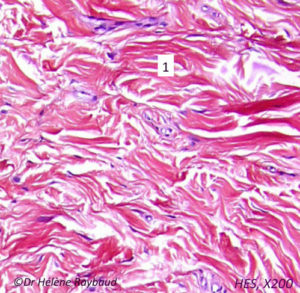 Cas 2 – Femme de 60 ans – Dermatologie buccale