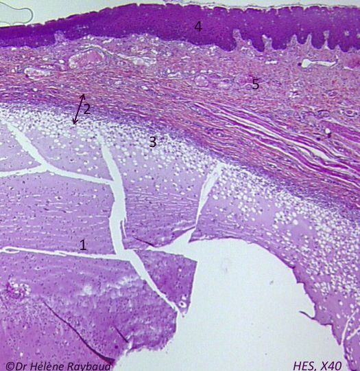 Cas 3 – Homme de 54 ans – Dermatologie buccale